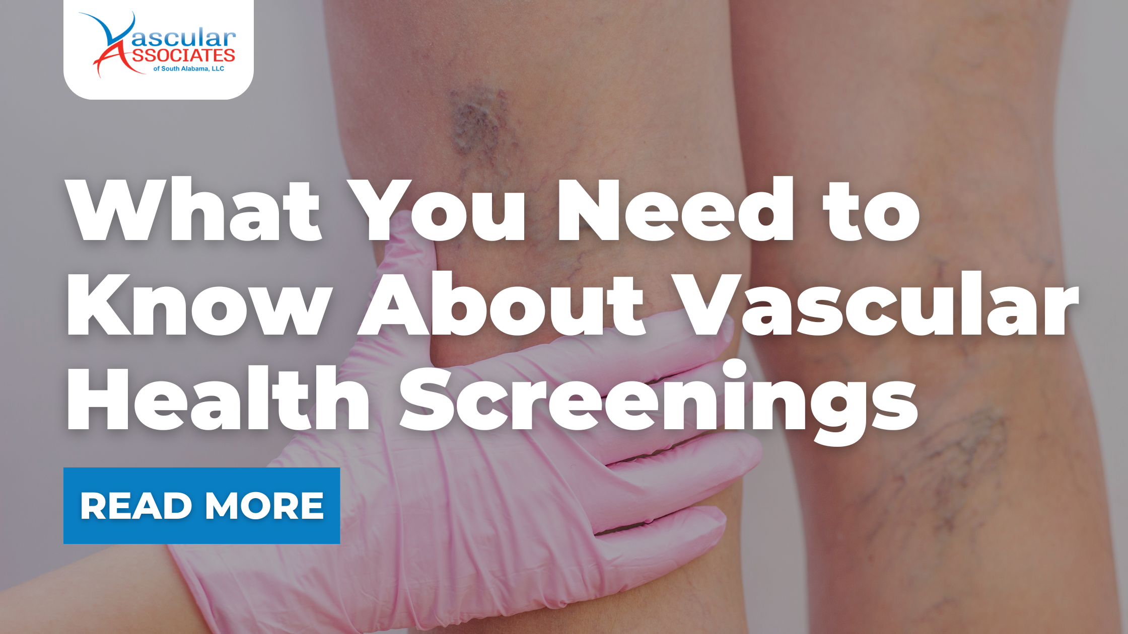 Vascular Associates Blog | Everything You Need to Know About Flyi